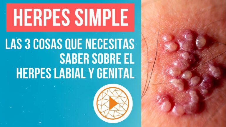 Todo lo que debes saber sobre las ampollas: causas tratamiento y prevención - Evangélico - Todo ...